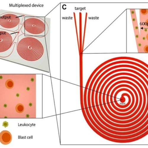 Bubbles in Microfluidics: How They Form and How to Avoid Them