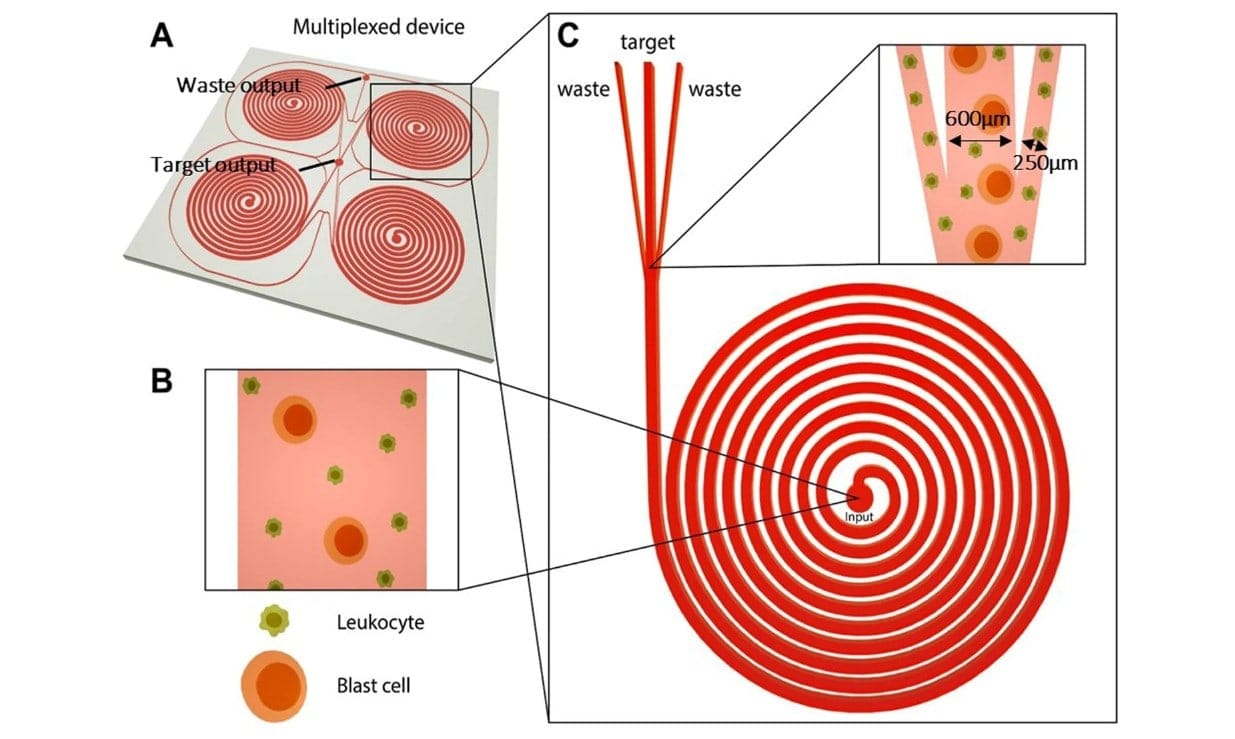 Microfluidics on Liquid Biopsy for Leukemia Patients | uFluidix
