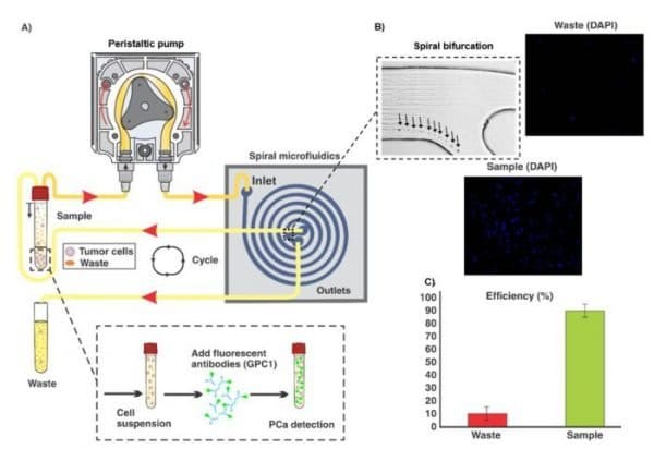 Label-Free Prostate Cancer Cell Isolation Using Microfluidics