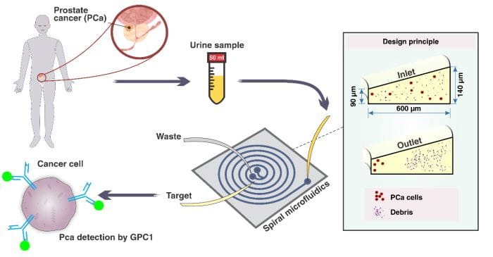 Label-Free Prostate Cancer Cell Isolation Using Microfluidics