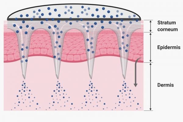 Microfluidic systems for precise drug delivery - uFluidix