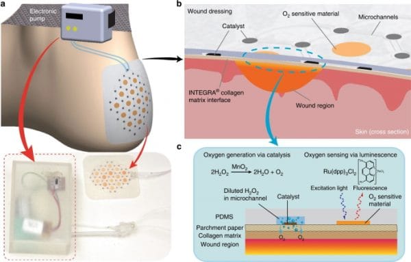 Microfluidic Bandage for Smart Wound Healing | uFluidix