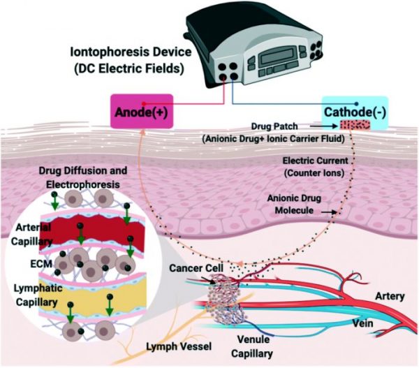 microfluidic chip cancer tumour cells | uFluidix