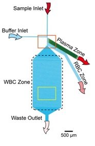 Blood Cell Separation Using Microfluidics-Review - uFluidix