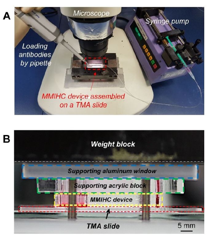 Microfluidic Biomarker Barcodes for High-Throughput Analysis