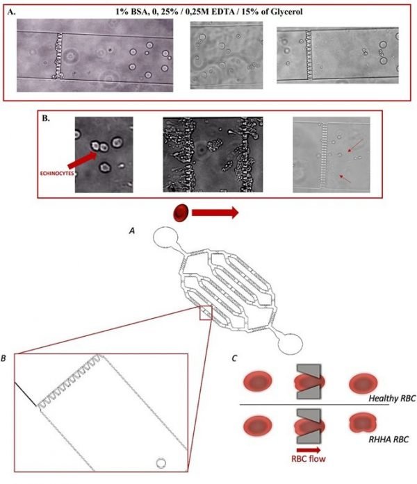 Microfluidic meets deep learning to analyze red blood cells | uFluidix