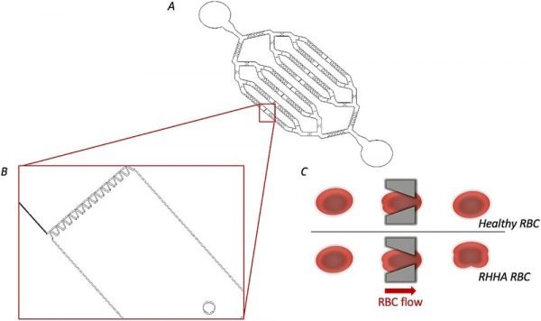 Microfluidic meets deep learning to analyze red blood cells | uFluidix