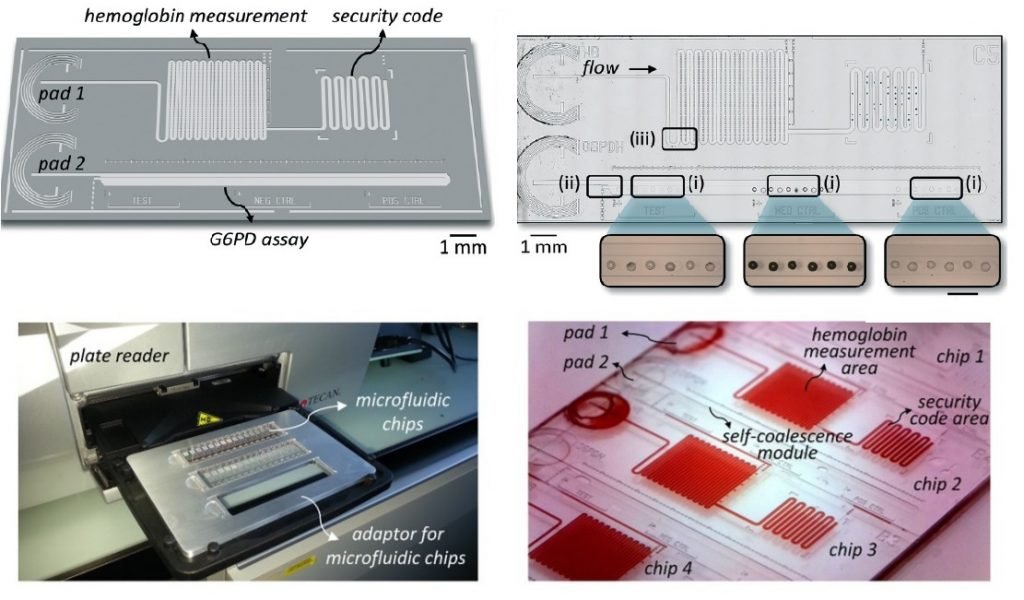 Microfluidic device for hemoglobin and G6PD analysis | uFluidix