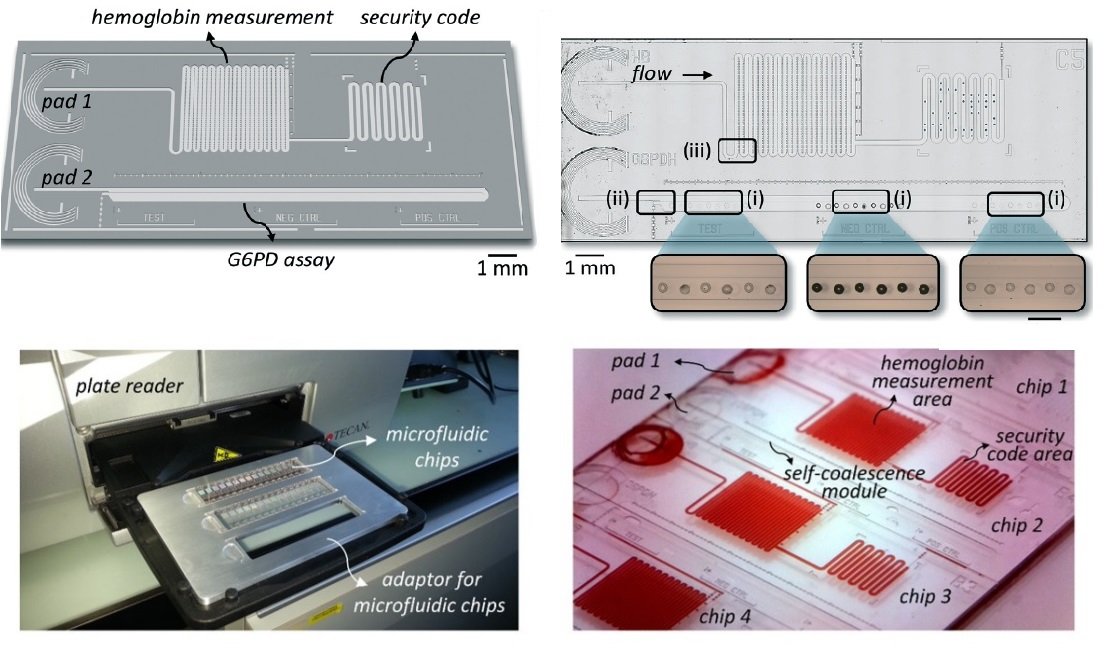 Microfluidic device for hemoglobin and G6PD analysis | uFluidix Microfluidic device for hemoglobin and G6PD analysis | uFluidix