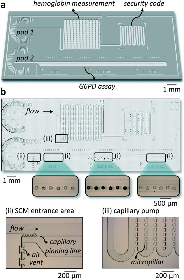 Microfluidic device for hemoglobin and G6PD analysis | uFluidix