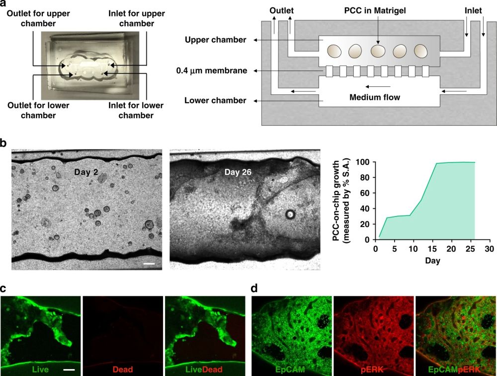 Pancreatic cancer-on-chip for drug efficacy analysis