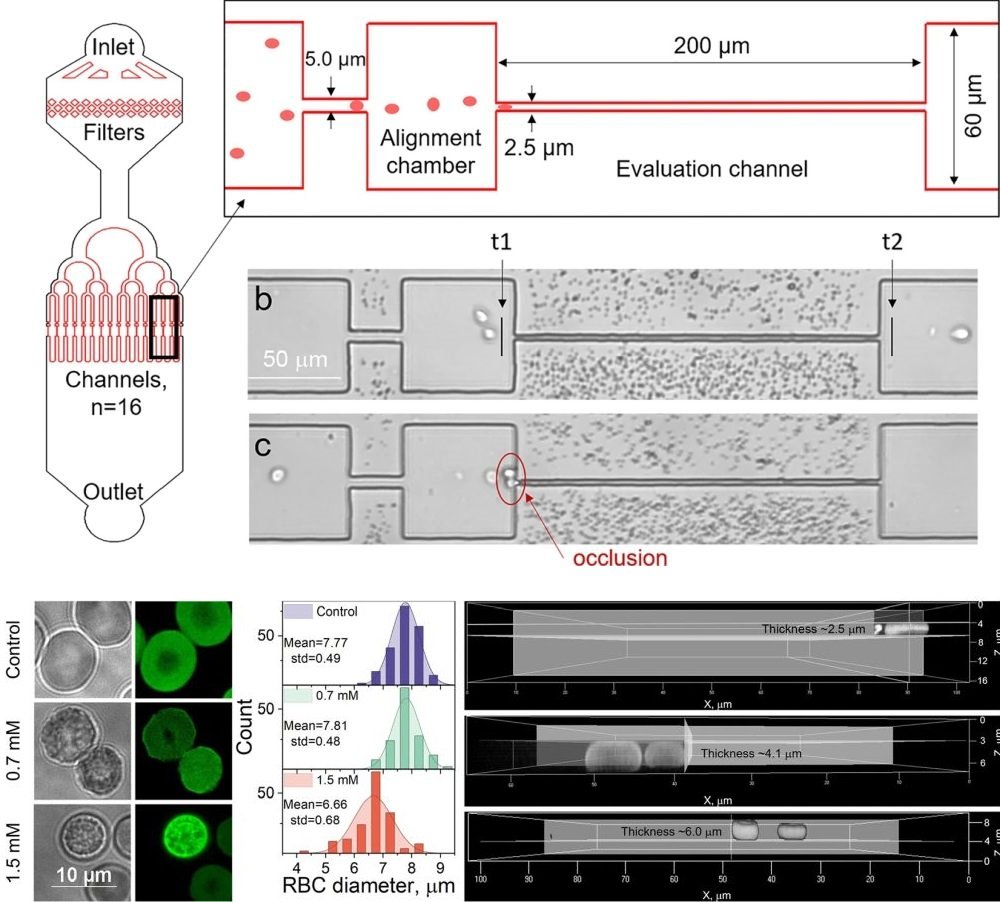 Microfluidics for RBC Antioxidant Capacity | uFluidix