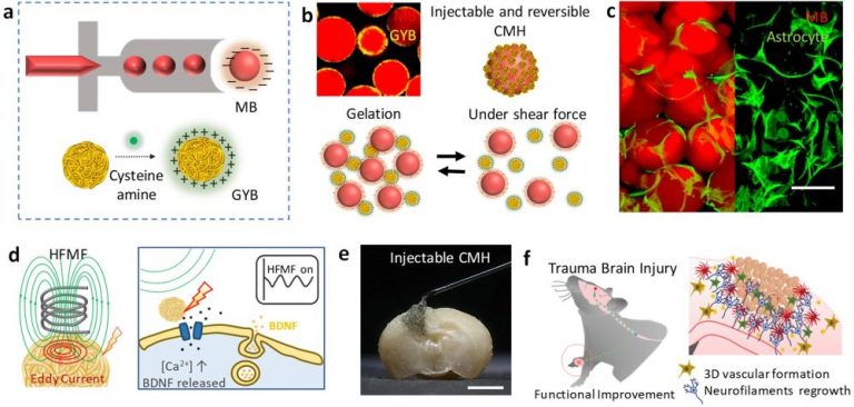 Microporous Hydrogels Enhance the Recovery of Brain Function