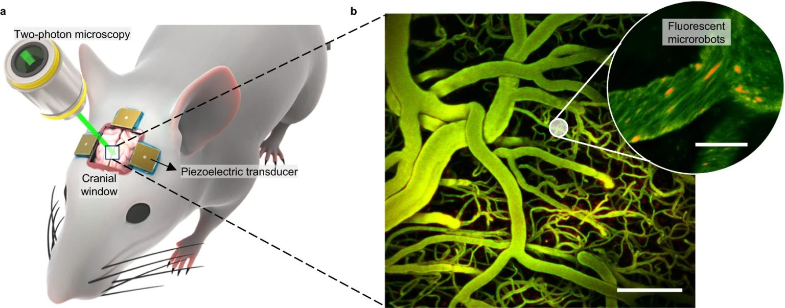 Navigating the Brain's Pathways: Ultrasound-Activated Microrobots Meet ...