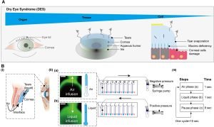 Exploring Dry Eye Syndrome with a Microfluidic Model