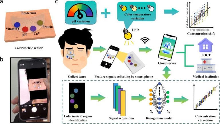 AI-Assisted Microfluidic Wearable Sensor for Tear Biomarkers