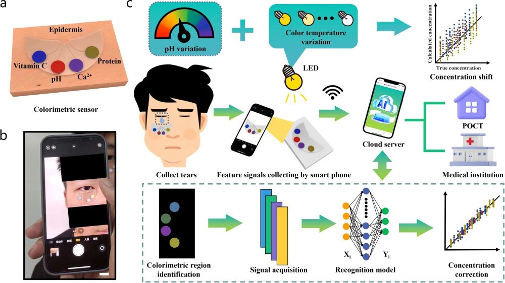 Ai Assisted Microfluidic Wearable Sensor For Tear Biomarkers