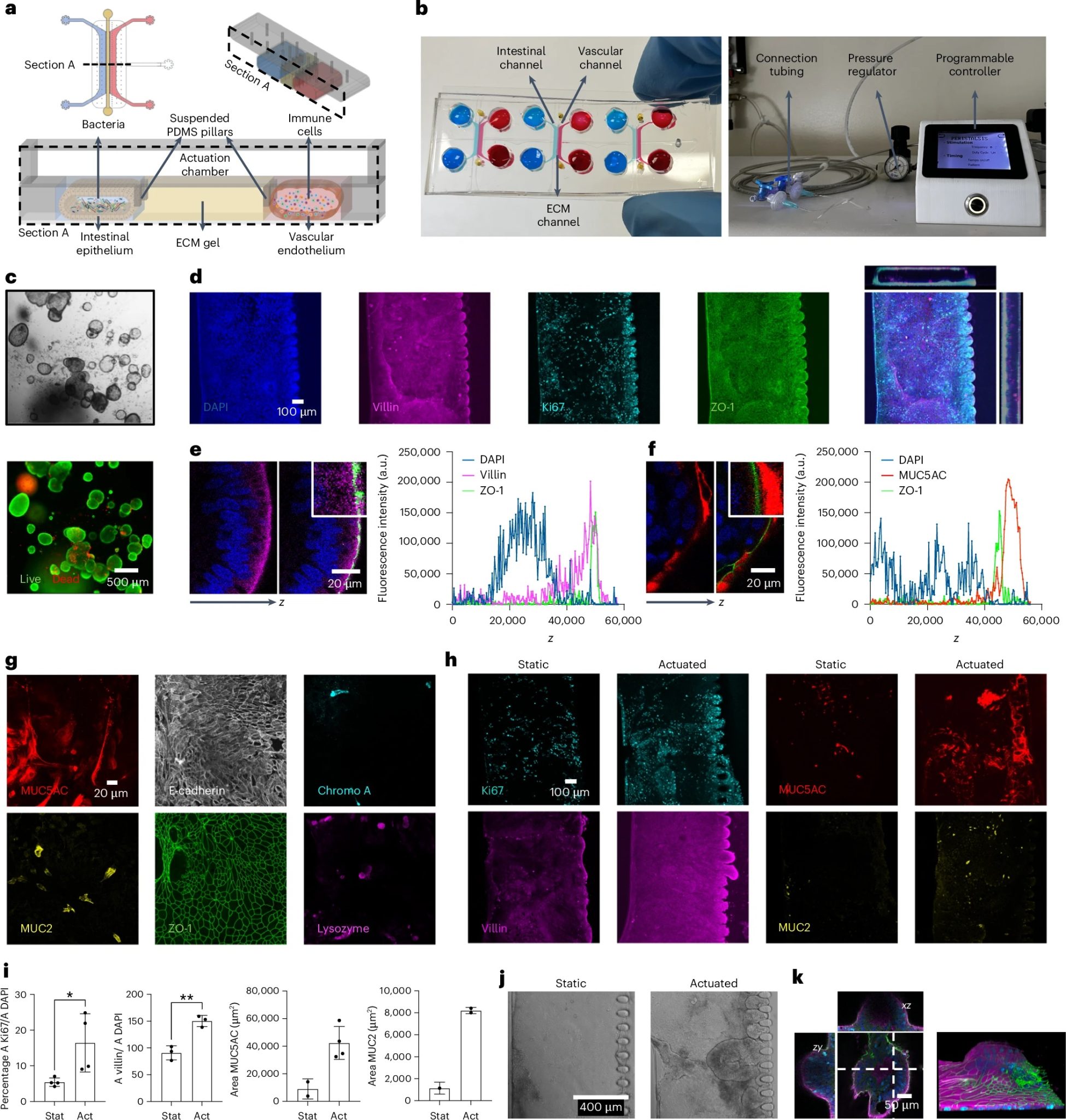 Understanding Microbiome Influence on Melanoma Treatment Using ...