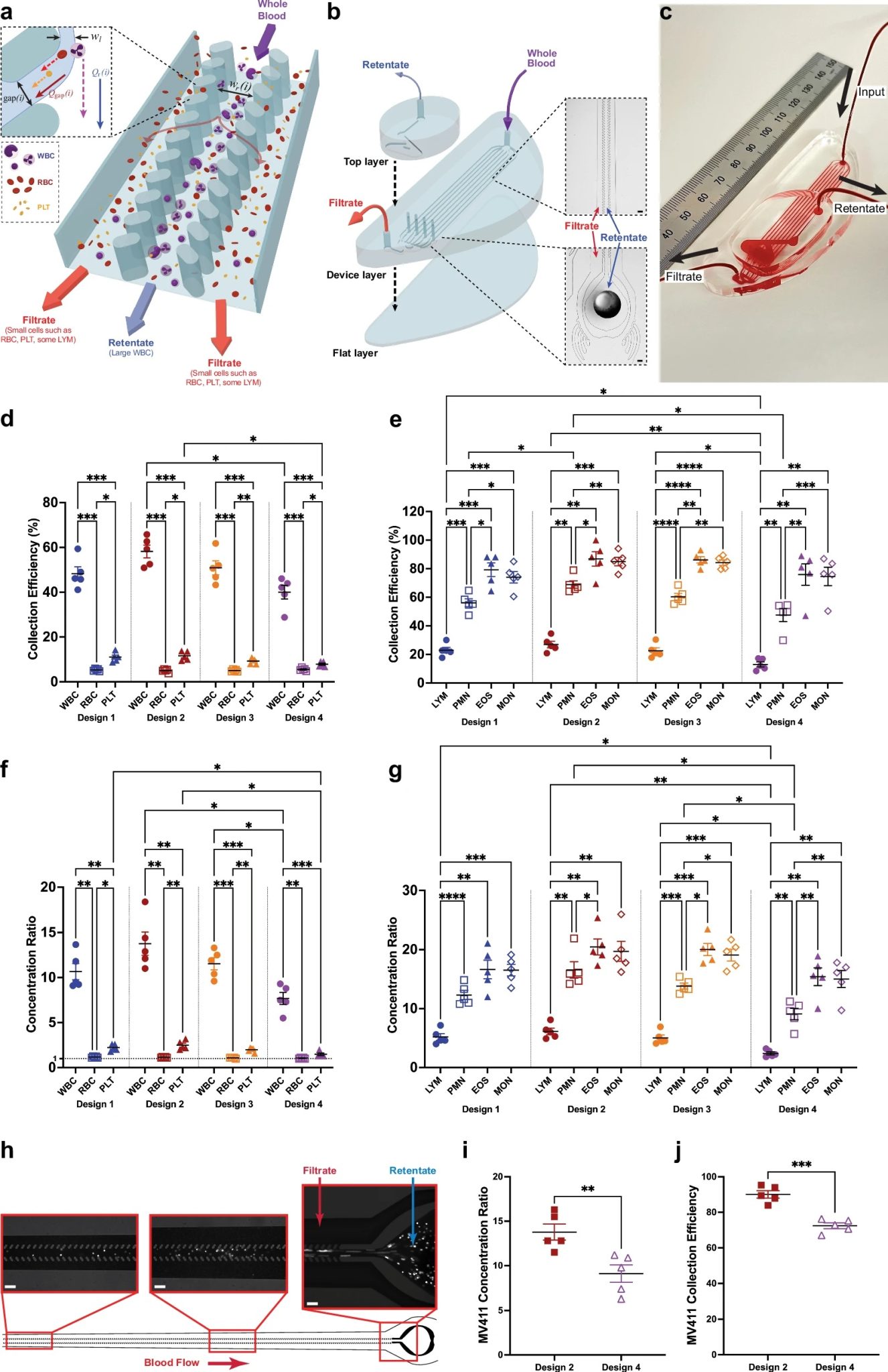 Exploring Microfluidic Leukapheresis for Pediatric Leukemia