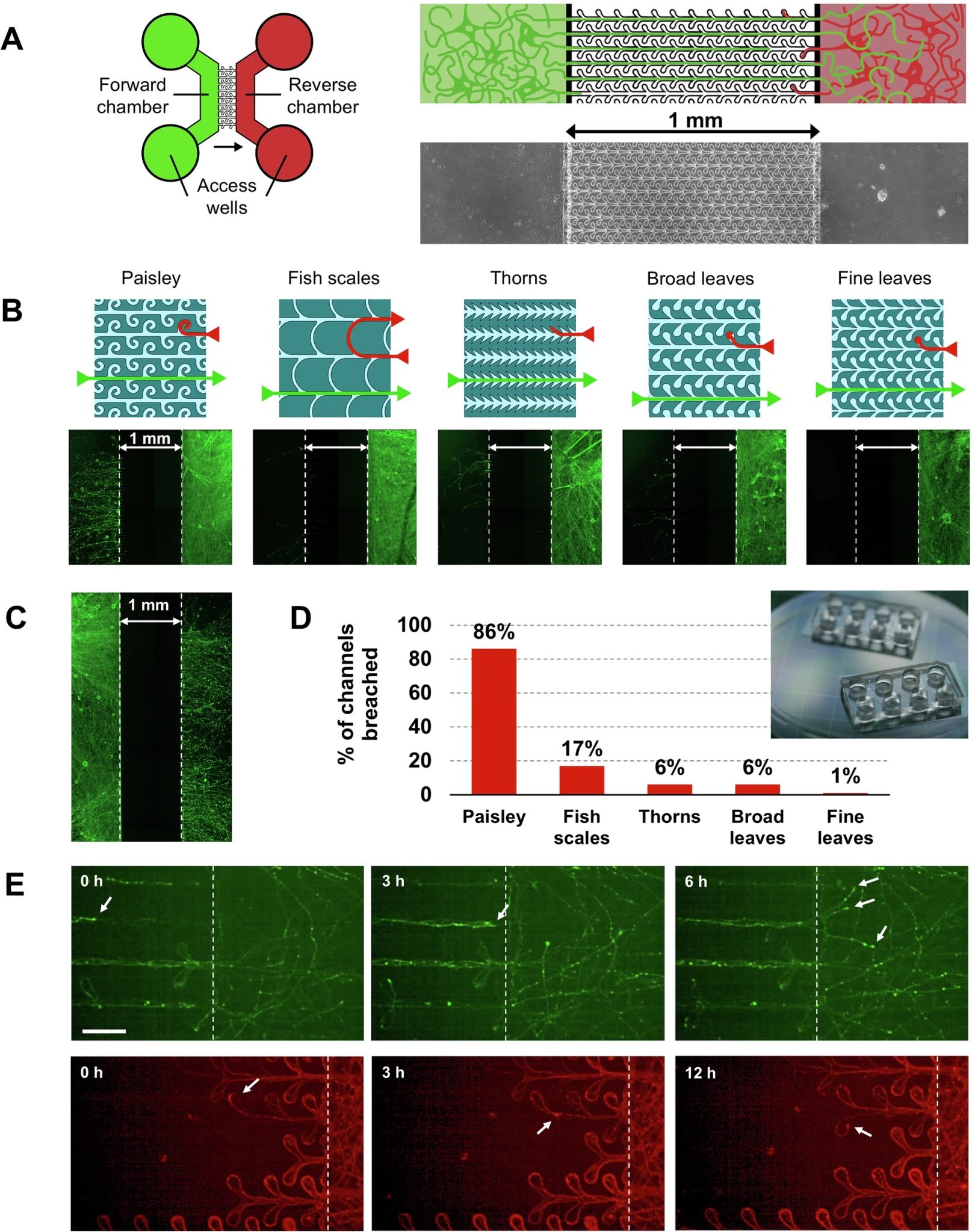 Microfluidic model shows alpha‑Synuclein spreads backward along axons