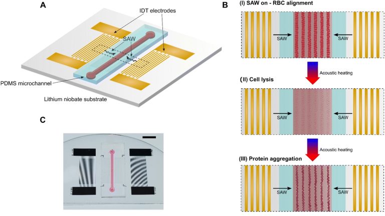 Acoustic probing for rapid sickle cell disease screening using ...